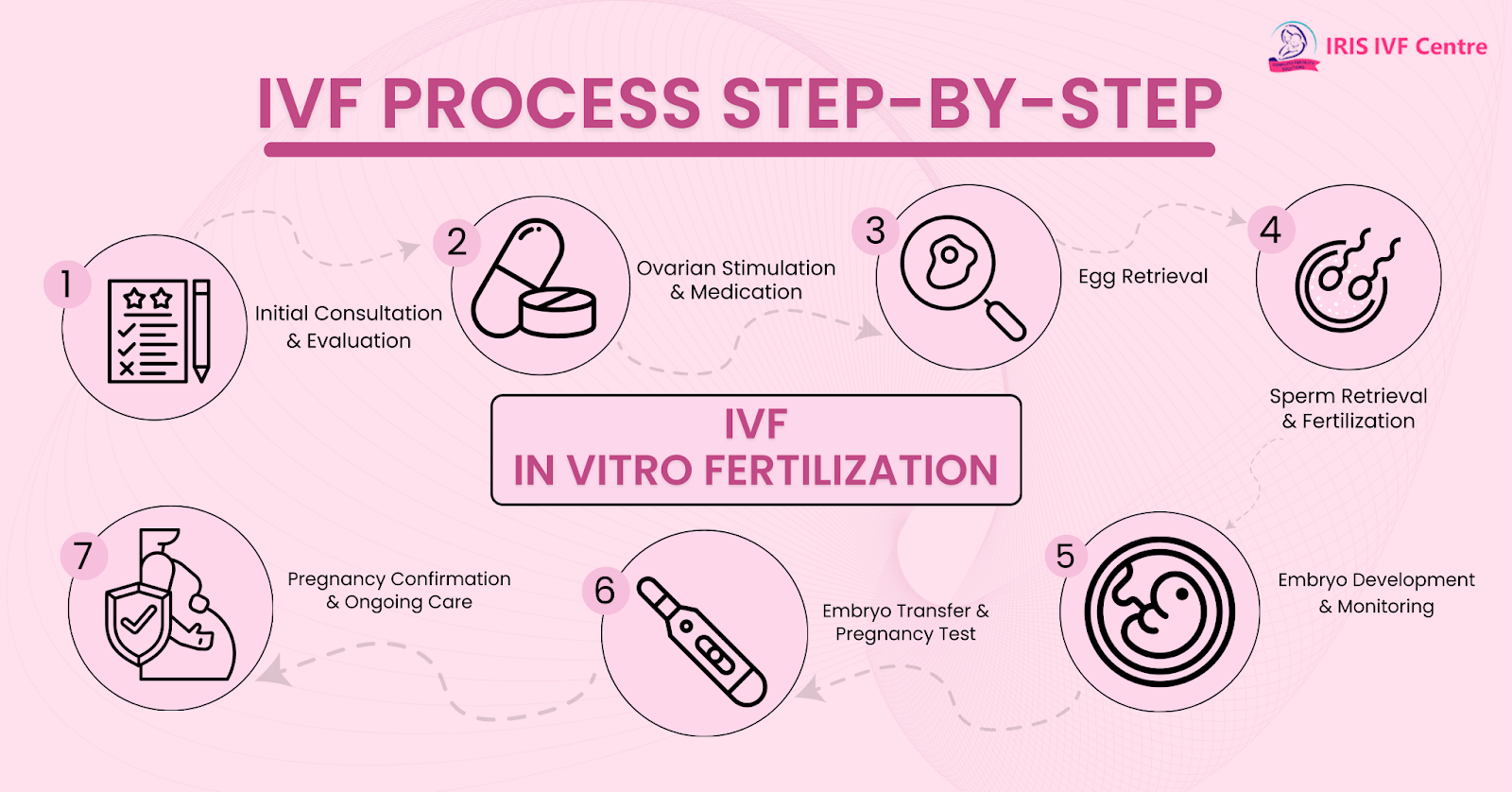 Understanding the IVF Process Step-by-Step: A Comprehensive Guide (2025 ... Understanding the IVF Process Step-by-Step: A Comprehensive Guide (2025 ...